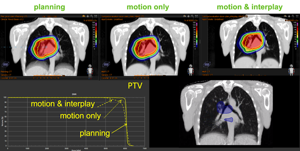 Motion Management – Overview | IBA Campus
